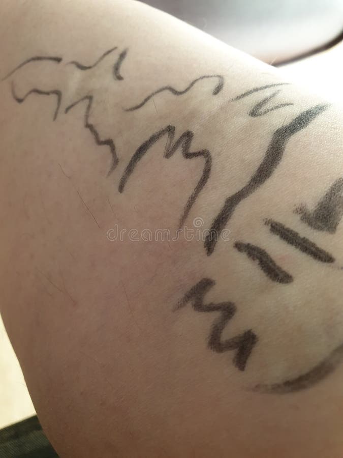 148 Surgery Markings Photos - Free & Royalty-Free Stock Photos from ...