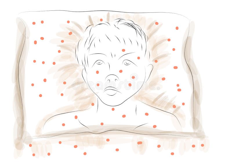 Masern Stock Illustrationen, Vektoren, & Kliparts - 12,934 Stock ...