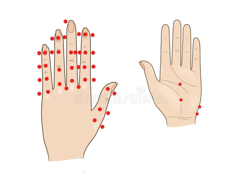 Les Points De Shiatsu Font Face à Lacuponcture De Massage Mode De