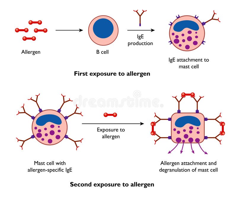 Mast cells and allergy stock vector. Illustration of allergen - 13000345