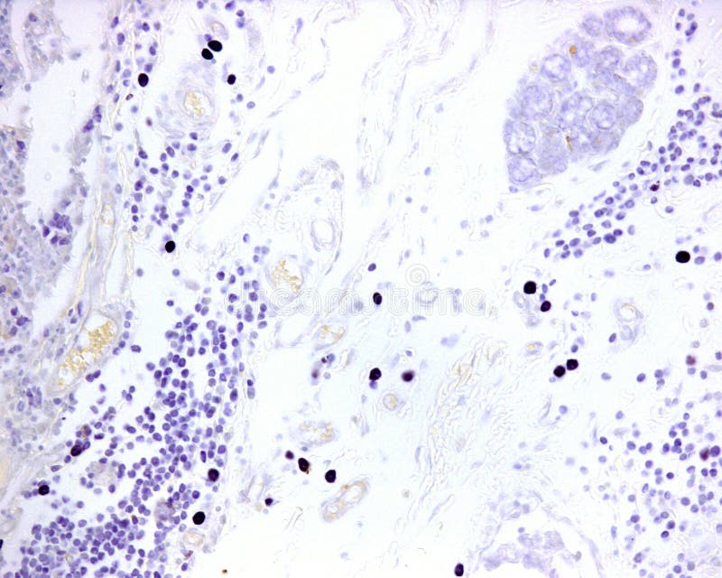 Connective Tissue. Mast Cells Stock Image - Image of mast, histological ...