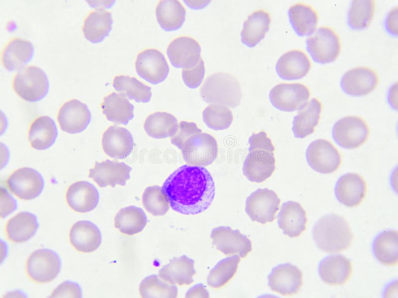 Mastcel of Een Mastocyte, Labrocyte Stock Foto - Image of steekproef ...