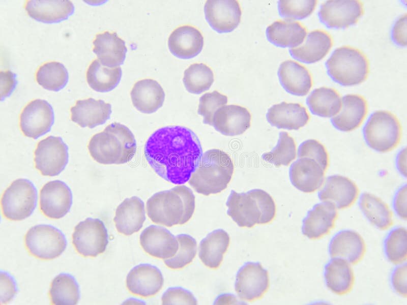 Mastcel of Een Mastocyte, Labrocyte Stock Afbeelding - Image of plaatje ...