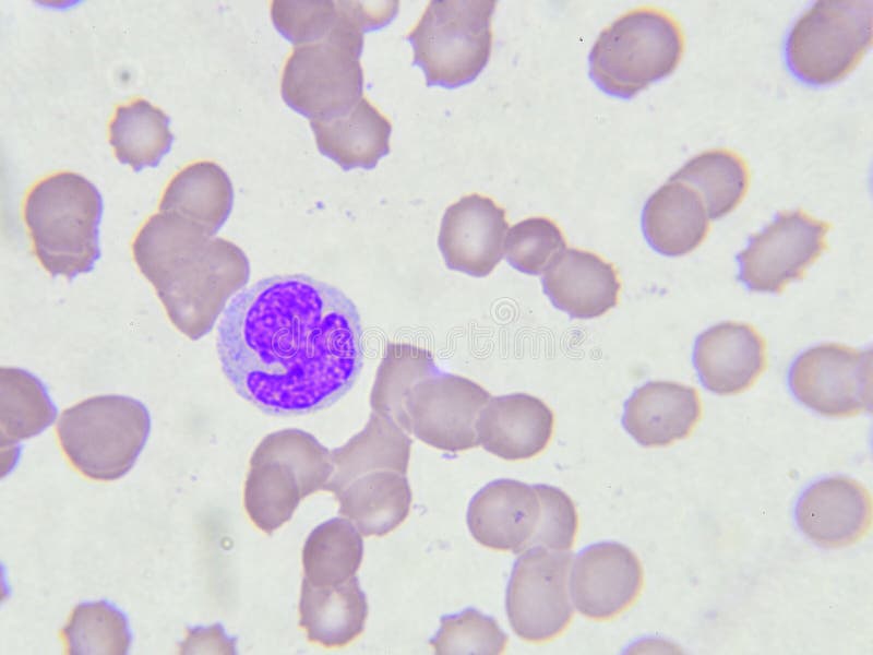 Mastcel of Een Mastocyte, Labrocyte Stock Foto - Image of ziekte ...