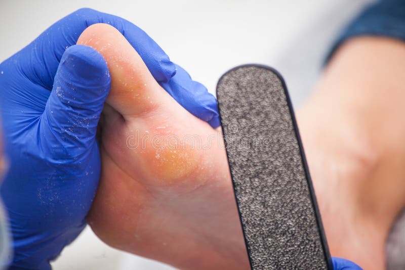Master Pedicurist Makes a Pedicure Female Legs Stock Photo - Image of ...