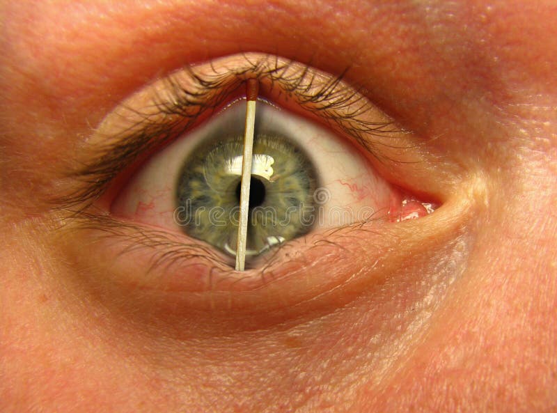 Match in eye. stock illustration. Illustration of match - 470815