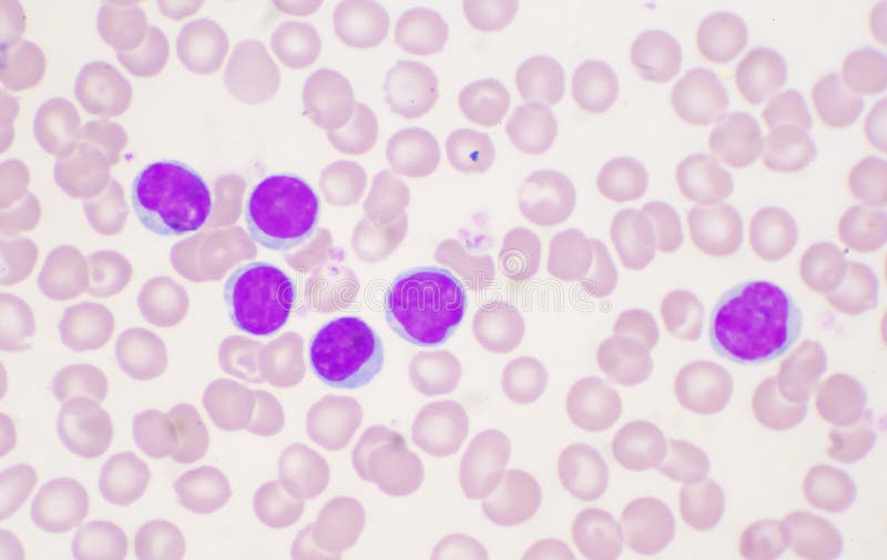 Mature Lymphocyte on Red Blood Cells Background Stock Photo - Image of ...