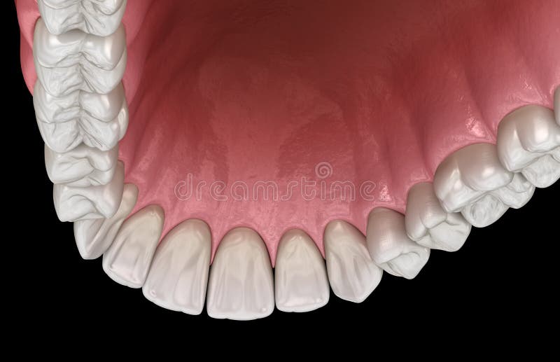 Maxillary Canine Stock Illustrations – 86 Maxillary Canine Stock ...