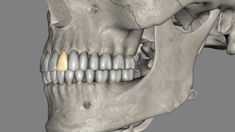 The Maxillary Lateral Incisors are a Pair of Upper (maxillary) Teeth ...