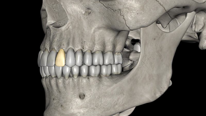 The Maxillary Lateral Incisors are a Pair of Upper (maxillary) Teeth ...
