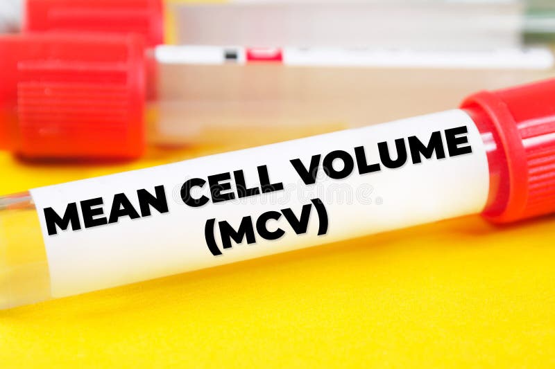 Mean Cell Volume (MCV) Text Meaning Analysis Stock Image - Image of ...