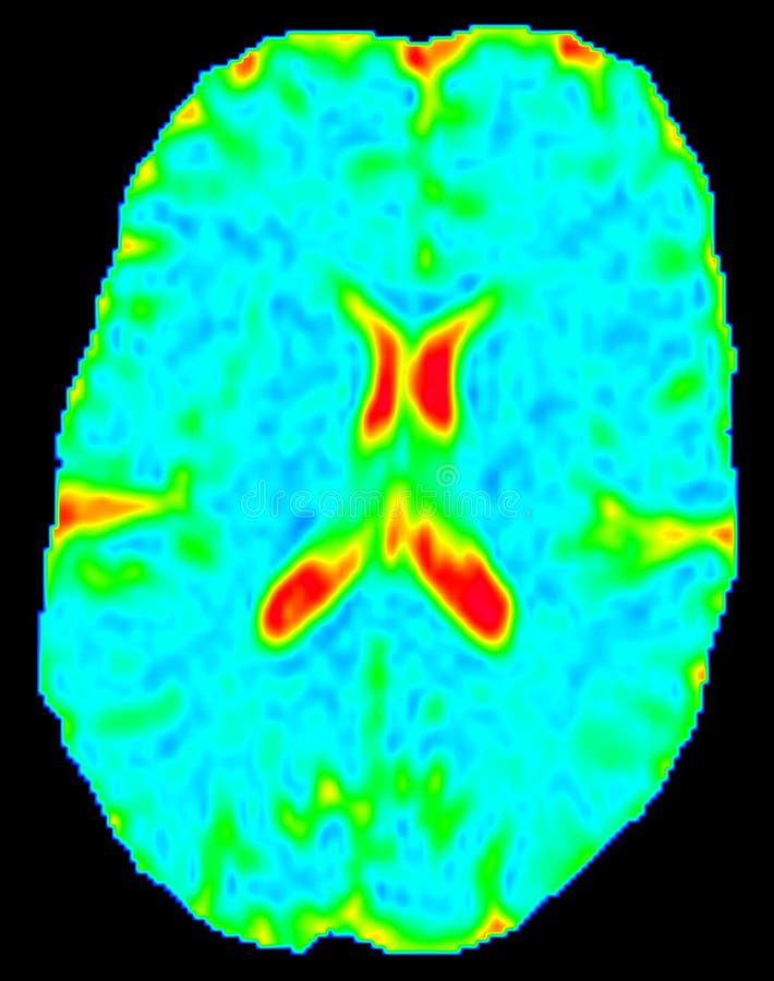 Brain Mri Map Stock Photos - Free & Royalty-Free Stock Photos from ...