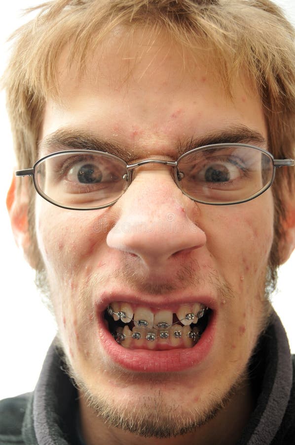 Mean man with braces stock image. Image of teenager, white - 11807195