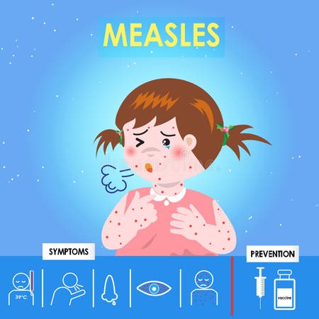 Measles Infographics Stock Illustrations – 42 Measles Infographics ...