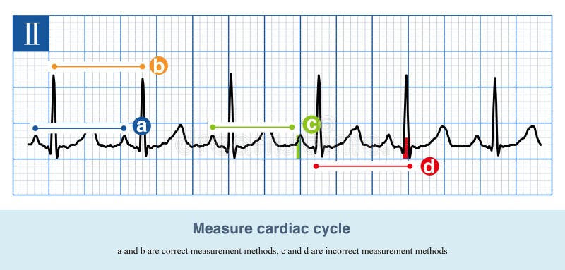 Measure cardiac cycle stock illustration. Illustration of heartbeat ...