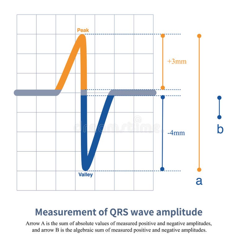 Amplitude Waveforms Stock Illustrations – 535 Amplitude Waveforms Stock ...