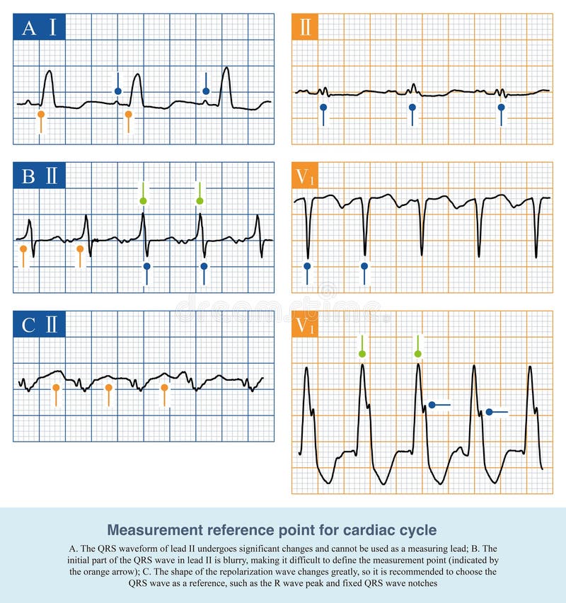 Measurement Reference Point for Cardiac Cycle Stock Photo - Image of ...
