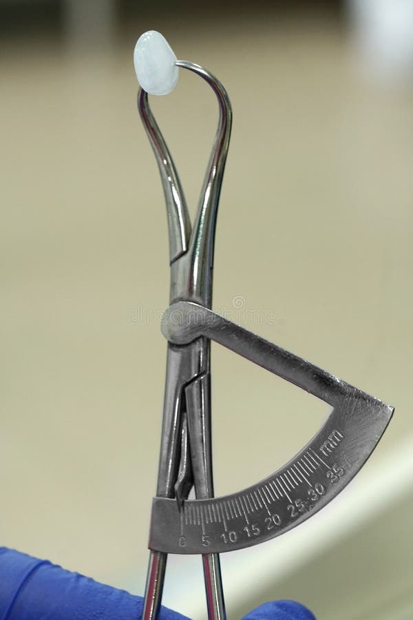 Measuring the Laminated Tooth Stock Photo - Image of material, oral ...