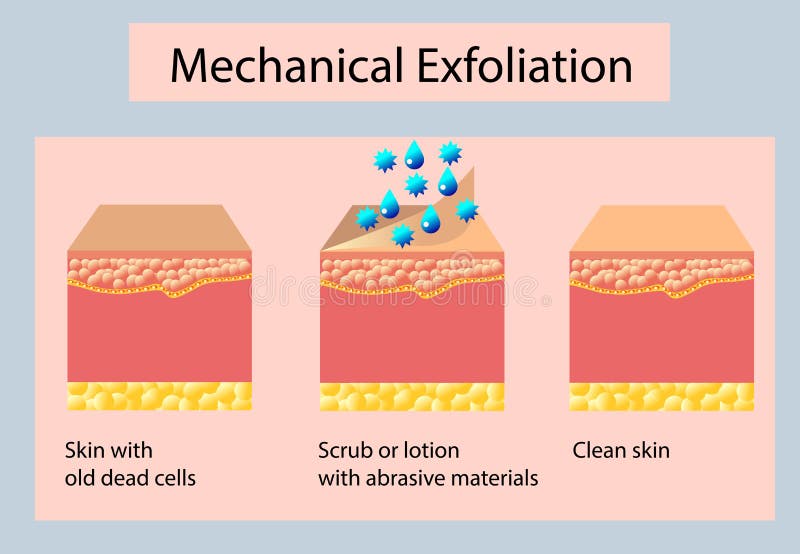 Exfoliation Diagram