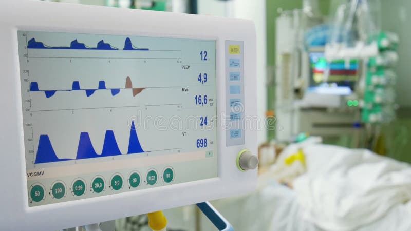 Mechanical Lung Ventilation in ICU Stock Video - Video of care ...