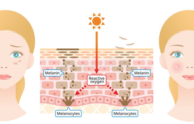 Diagram of Regular Skin Cell Turnover and Slow Skin Cell Turnover Stock ... Diagram of Regular Skin Cell Turnover and Slow Skin Cell Turnover Stock ...