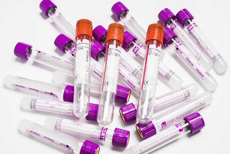 Medecin Test Tubes for Labaroth Studies and Blood Tests. Equipment ...