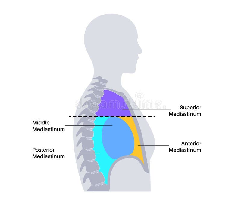 Mediastinum Infographic Poster Stock Illustration - Illustration of ...