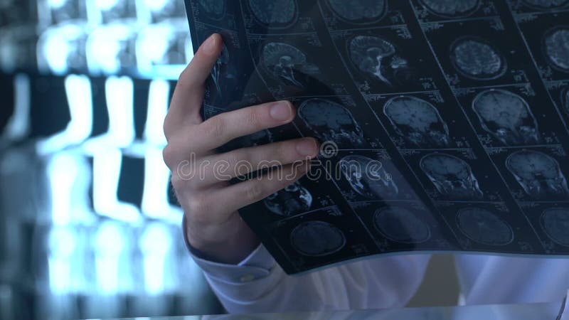 Medic Intern Analyzing Brain X-ray Image, Students Anatomy Research ...