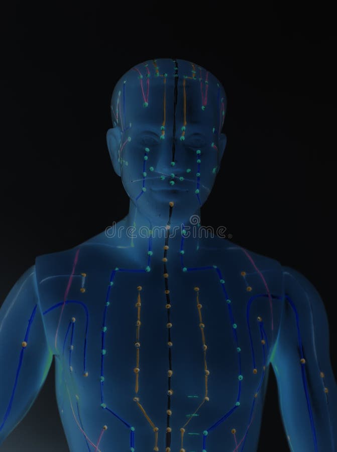 Cupping Massage the Back of a Woman Stock Image - Image of baguar ...