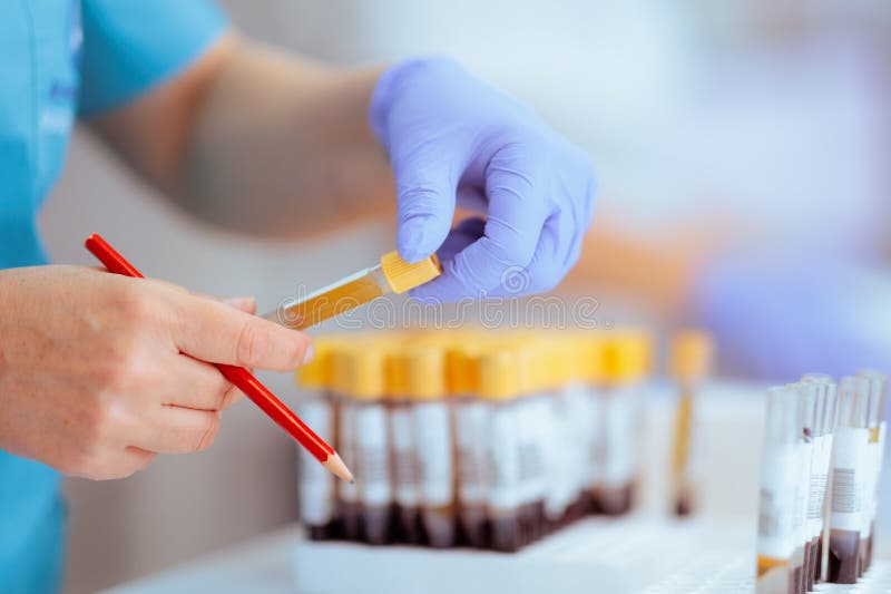 Medical Assistant Holding Blood Sample in a Laboratory for Testing ...