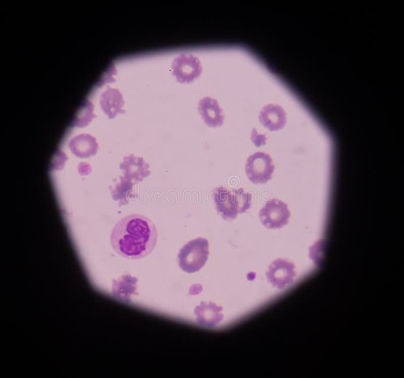 Medical background stock photo. Image of hemoglobin, bone - 67307730