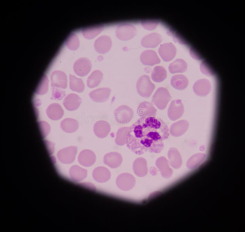 Medical background stock image. Image of leukocyte, eosinophil - 67307737