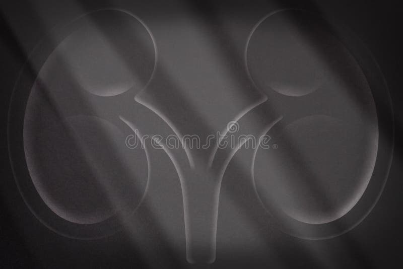 Medical Background on the Kidney Gray Stock Illustration - Illustration ...