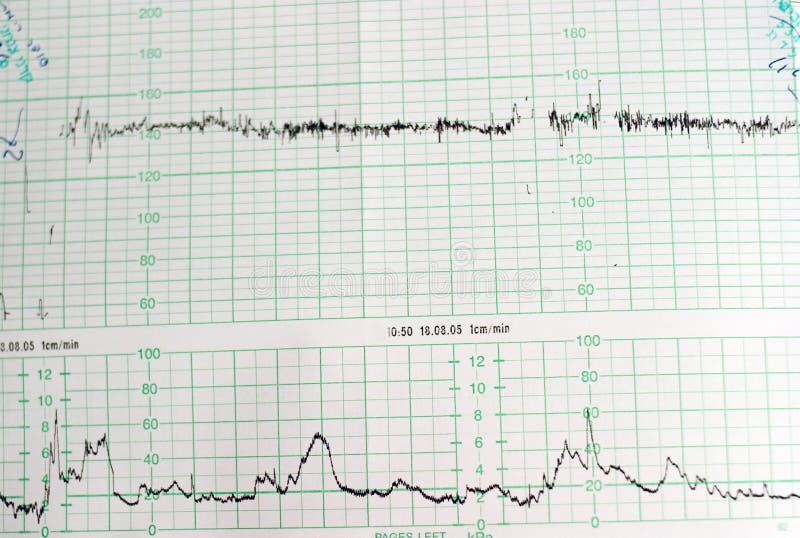Medical Chart stock photo. Image of medical, hospitalized - 206556