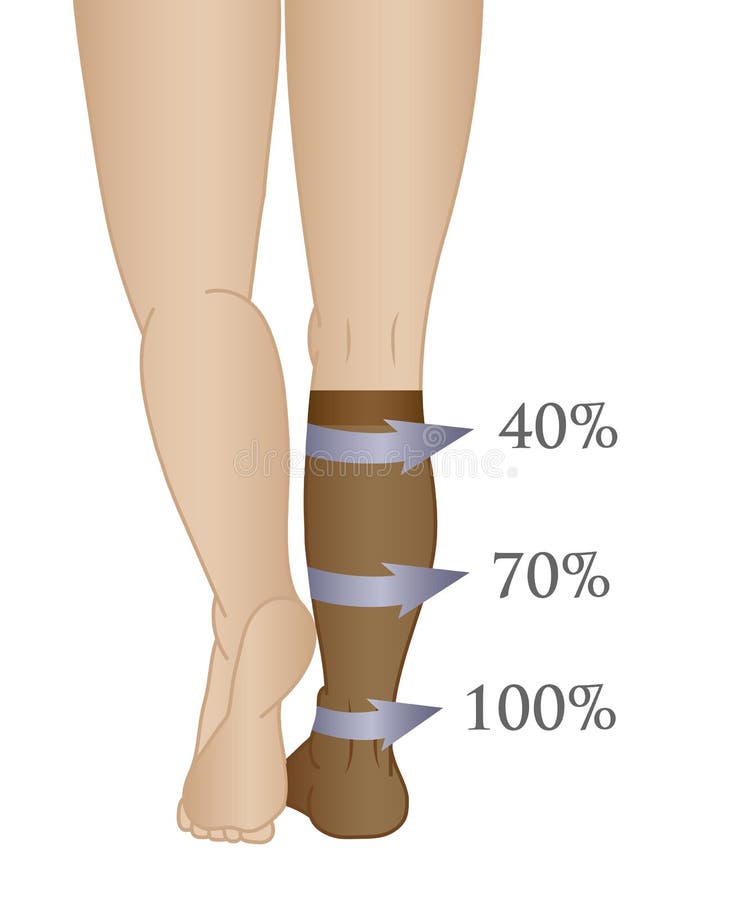Medical Compression Hosiery Stock Vector - Illustration of condition ...