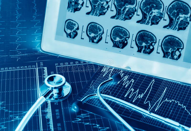 Medical Concept, Stethoscope on Ecg Chart Stock Image - Image of ...