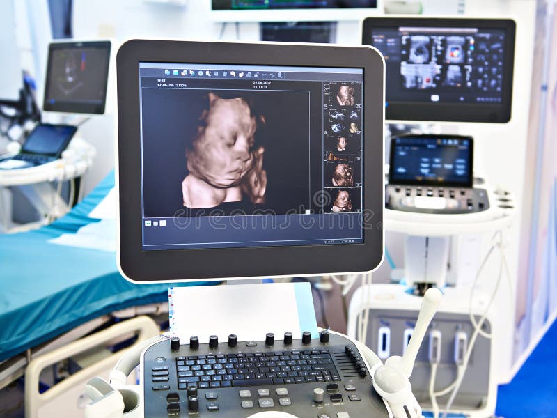 Medical Ultrasound Devices on Exhibition Stock Photo - Image of screen ...