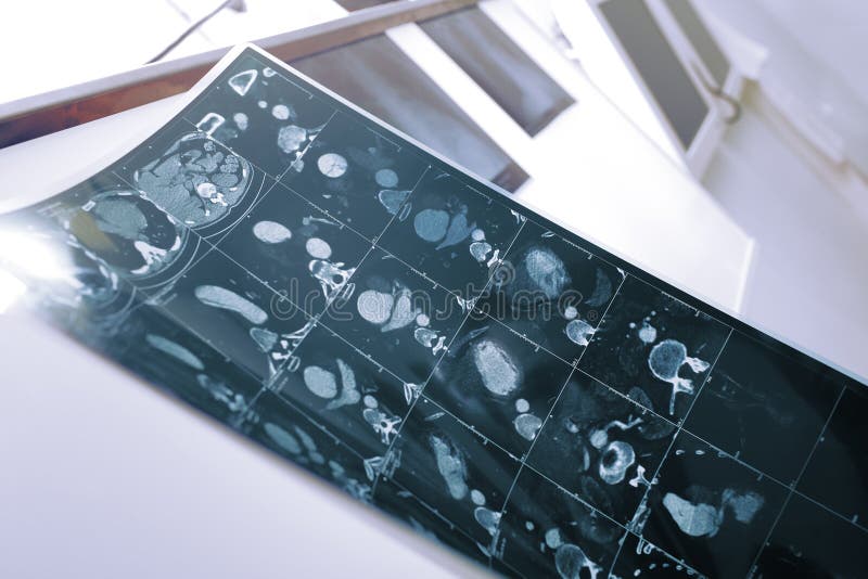 Medical Diagnostics Concept with CT, X-ray Films in the Doctors Office ...