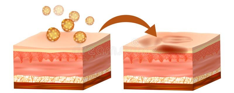 Penetration Layers Stock Illustrations – 55 Penetration Layers Stock ...