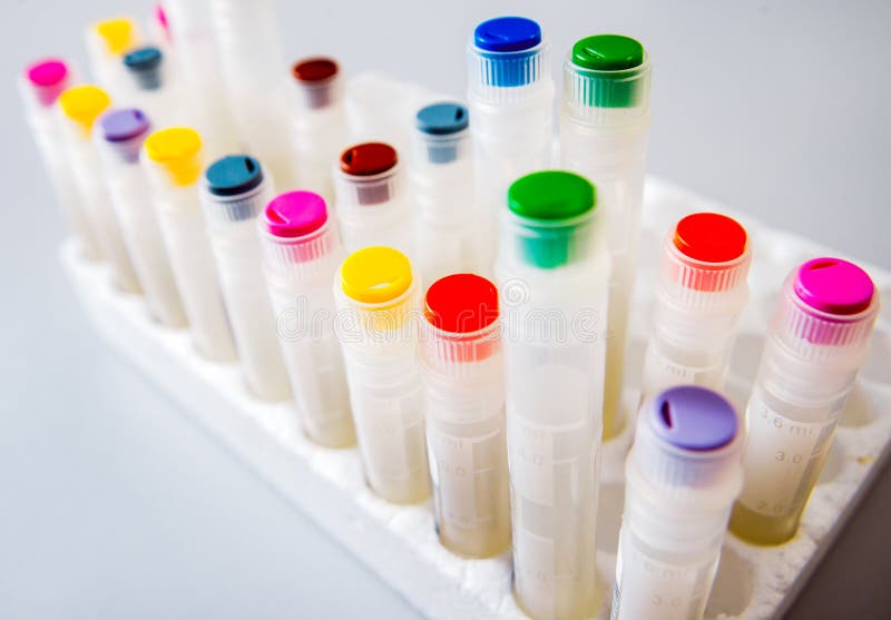 Medical Equipment. Biochemistry Test. Tubes and Containers Stock Image ...