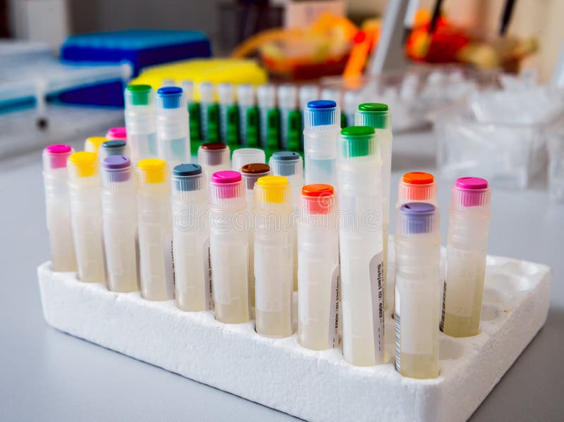 Medical Equipment. Biochemistry Test. Tubes and Containers Stock Photo ...