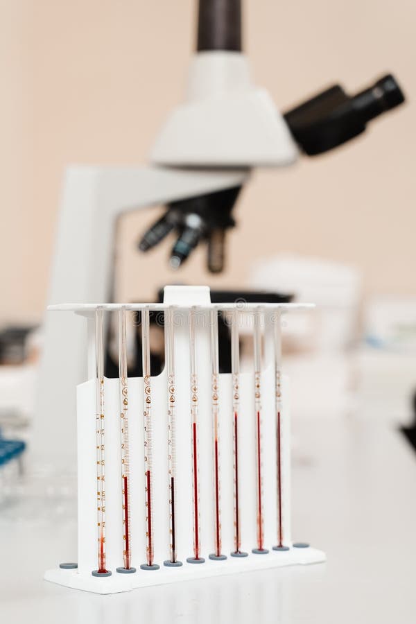 Medical Equipment for Blood Test and Analysis Using Microscope, Micro ...