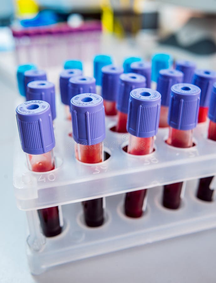 Equipment and Tubes for Mixing Fluids in the Chemistry Lab Stock Image ...