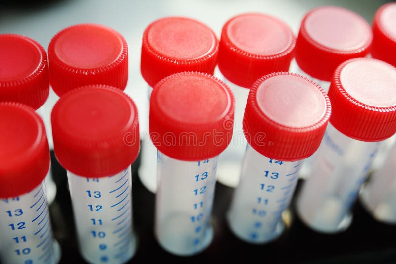 Medical flask for blood stock photo. Image of biochemistry - 88196412