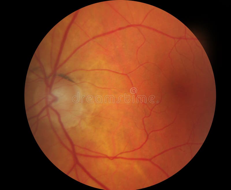 Fundus photo Free Stock Photos - StockFreeImages