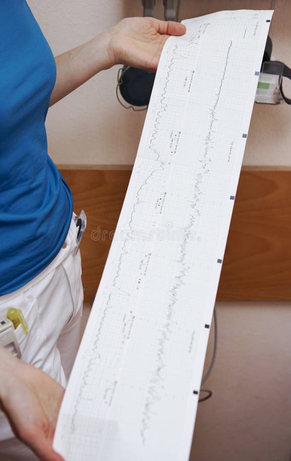Medical Graph of Contractions Stock Image - Image of examination ...
