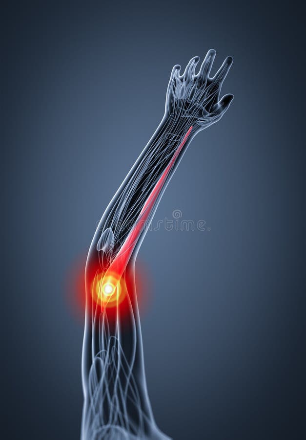 Medical Illustration of the Brachioradialis Stock Illustration ...