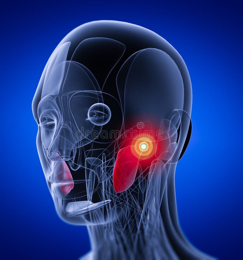 Medical Illustration of the Masseter Stock Illustration - Illustration ...