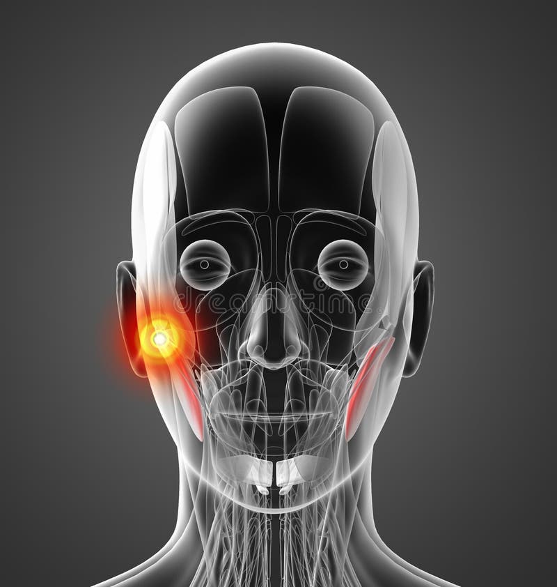 Medical Illustration of the Masseter Stock Illustration - Illustration ...