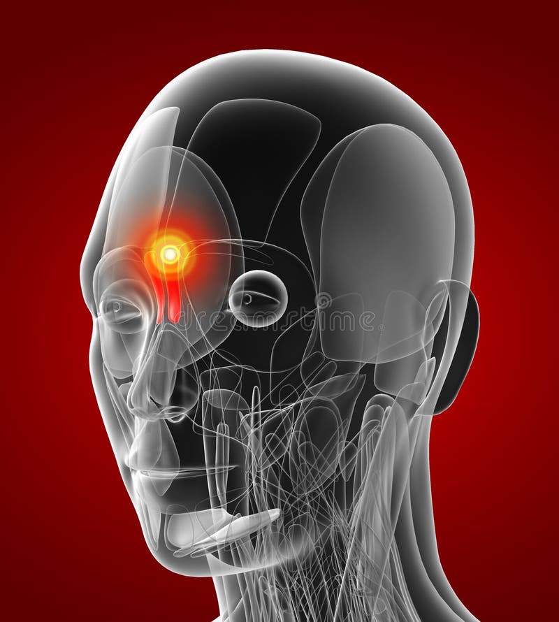 Medical Illustration of the Procerus Stock Illustration - Illustration ...